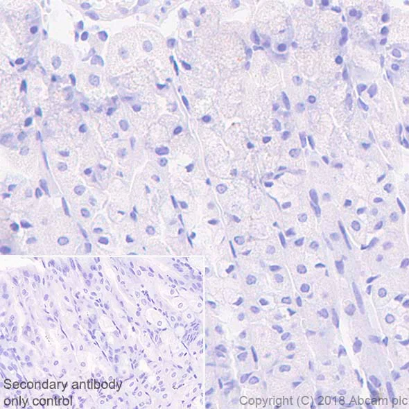 Rabbit IgG, monoclonal [SP137] - isotype control (ab125938) | Abcam