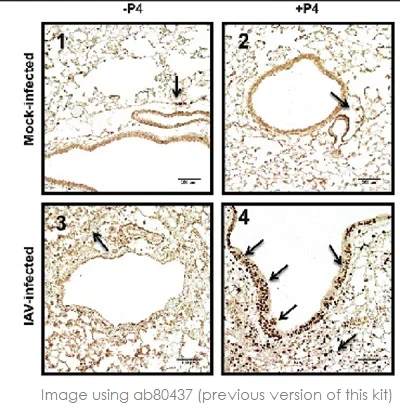 Rabbit specific HRP/DAB Detection IHC Detection Kit (ab236469) | Abcam