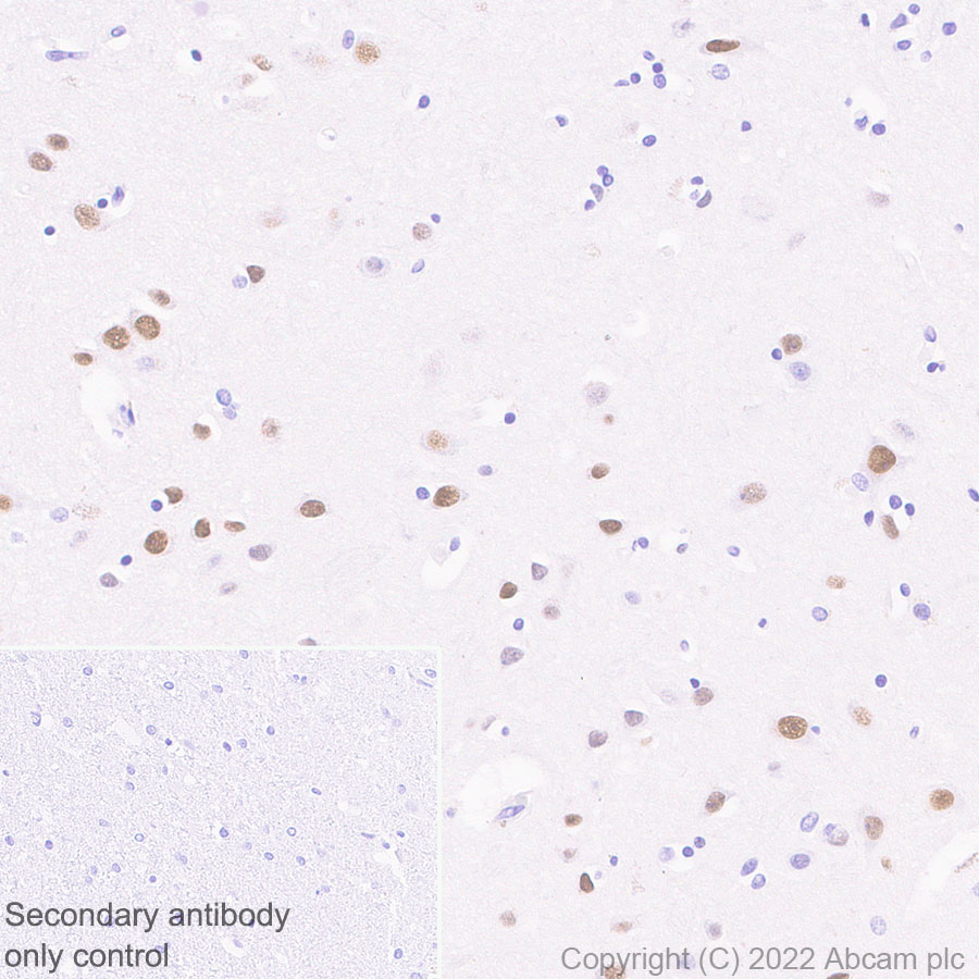Rabbit specific IHC polymer detection kit HRP/DAB (ab209101) | Abcam