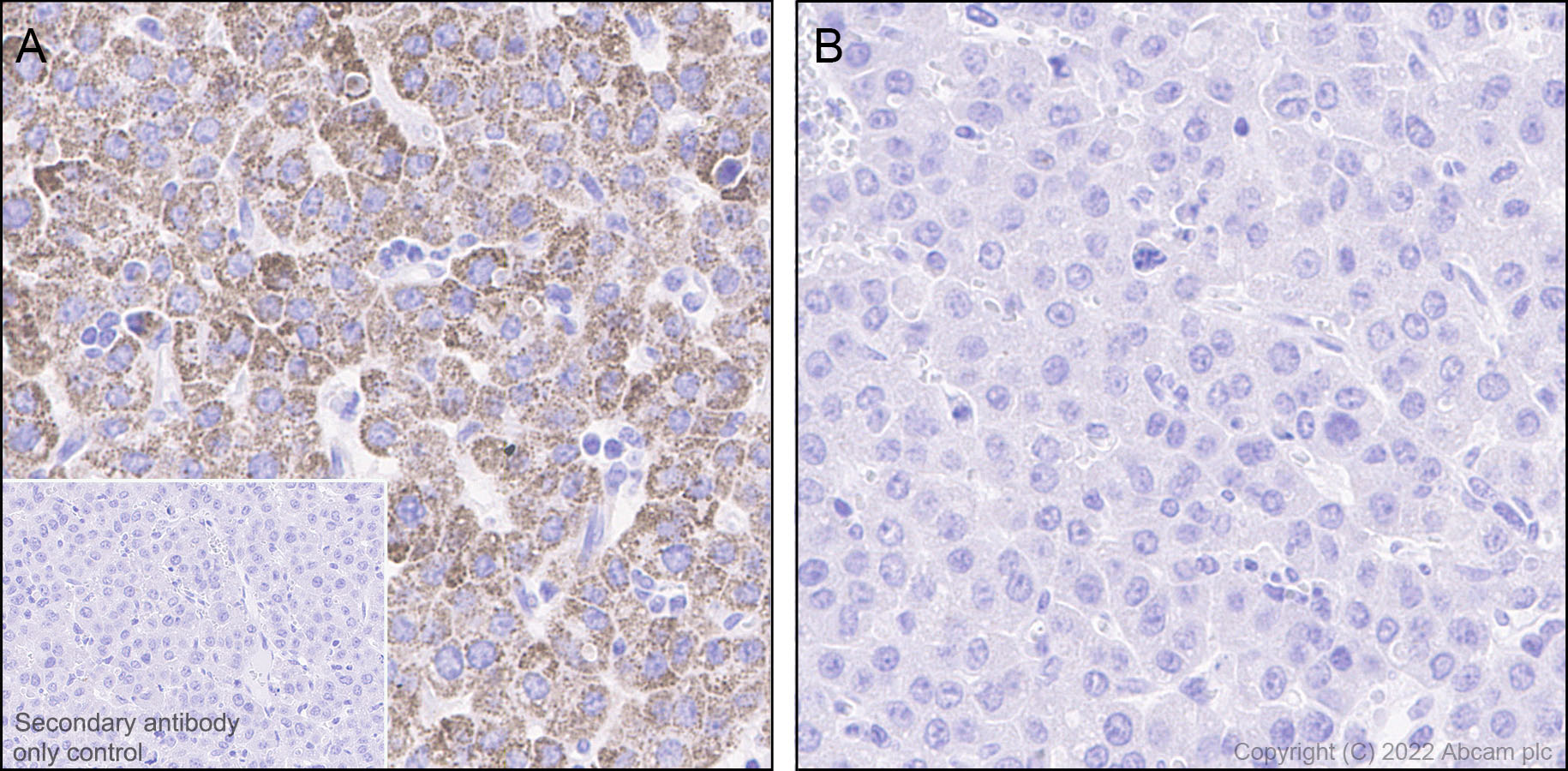 Rabbit specific IHC polymer detection kit HRP/DAB (ab209101) | Abcam