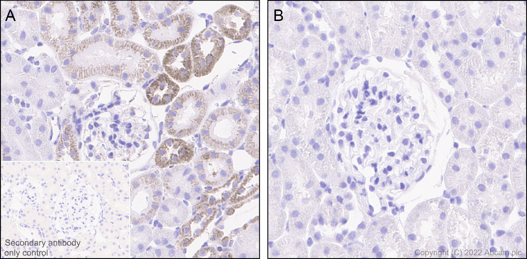 Rabbit specific IHC polymer detection kit HRP/DAB (ab209101) | Abcam