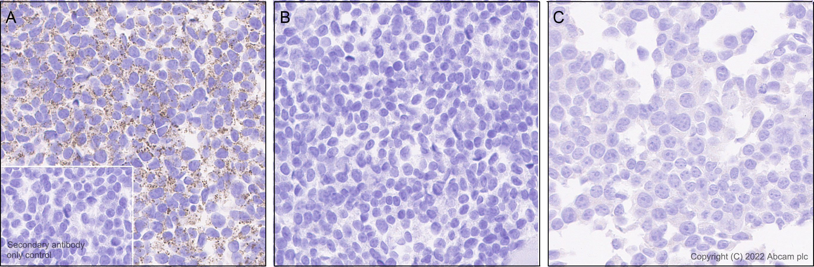 Rabbit specific IHC polymer detection kit HRP/DAB (ab209101) | Abcam