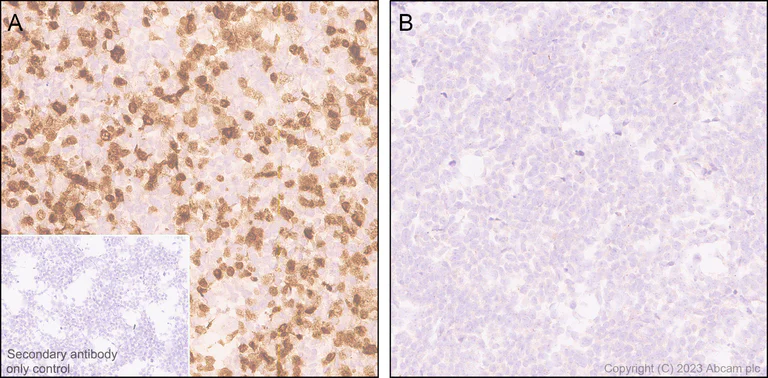 兔specific IHC polymer detection试剂盒HRP/DAB (ab209101)| Abcam中文官网