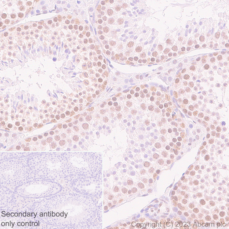 Rabbit specific IHC polymer detection kit HRP/DAB (ab209101) | Abcam