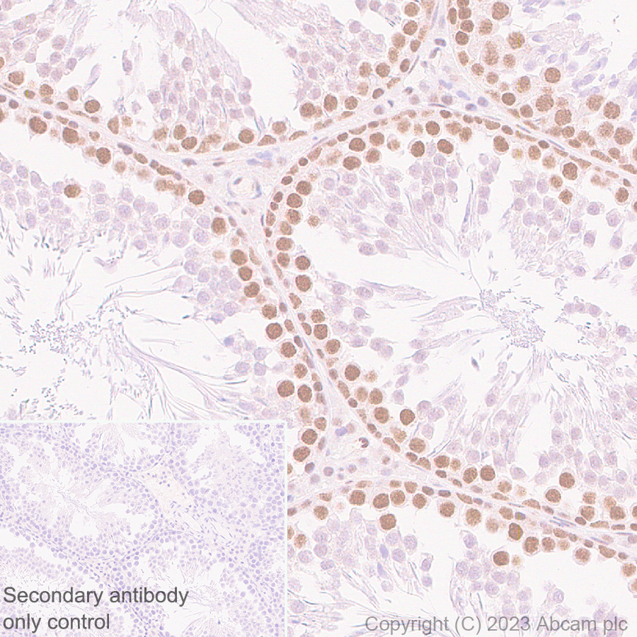Rabbit specific IHC polymer detection kit HRP/DAB (ab209101) | Abcam