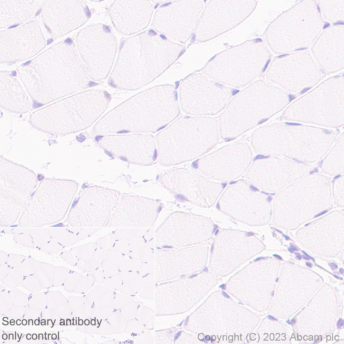 Rabbit specific IHC polymer detection kit HRP/DAB (ab209101) | Abcam