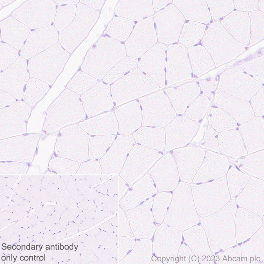Rabbit specific IHC polymer detection kit HRP/DAB (ab209101) | Abcam