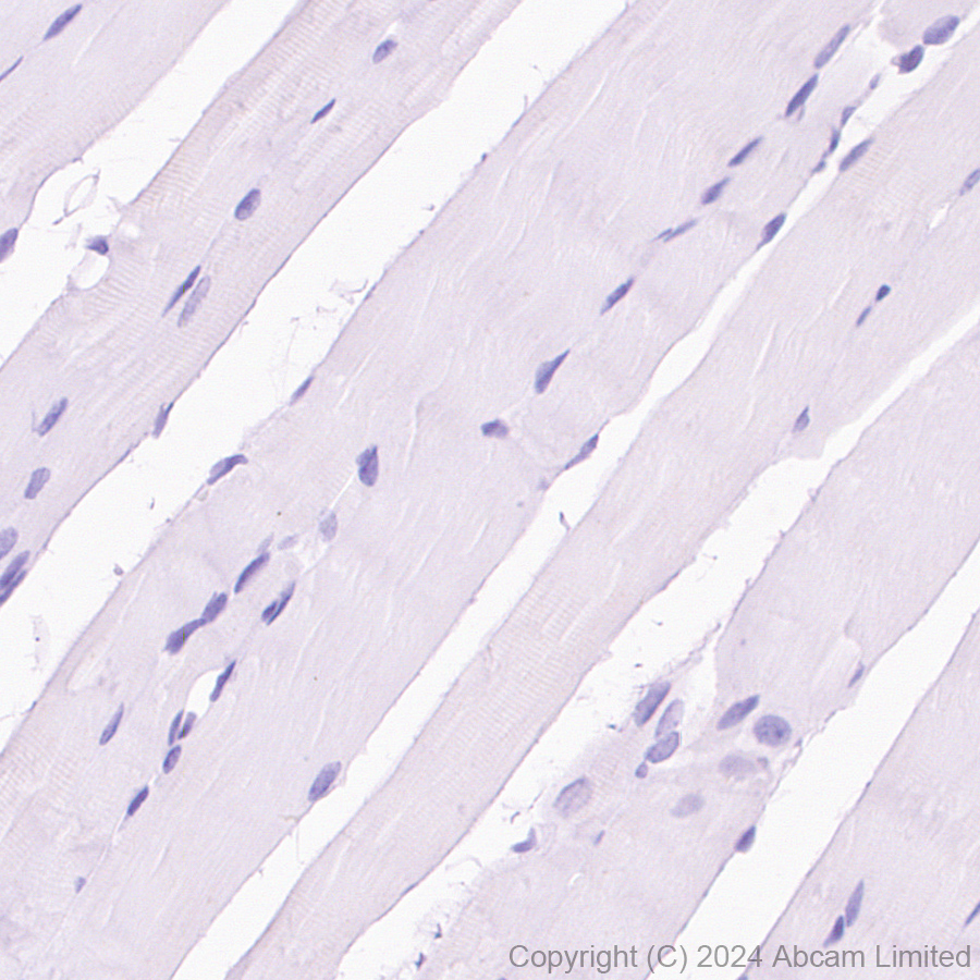 Rabbit specific IHC polymer detection kit HRP/DAB (ab209101) | Abcam
