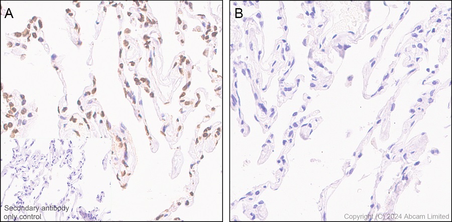 Rabbit specific IHC polymer detection kit HRP/DAB (ab209101) | Abcam