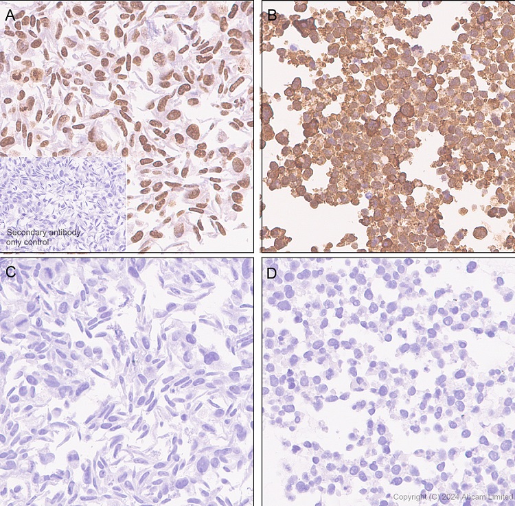 Rabbit specific IHC polymer detection kit HRP/DAB (ab209101) | Abcam