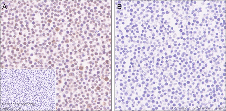 Rabbit specific IHC polymer detection kit HRP/DAB (ab209101) | Abcam