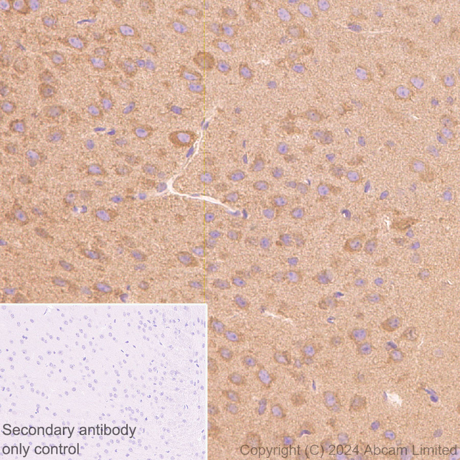 Rabbit specific IHC polymer detection kit HRP/DAB (ab209101) | Abcam