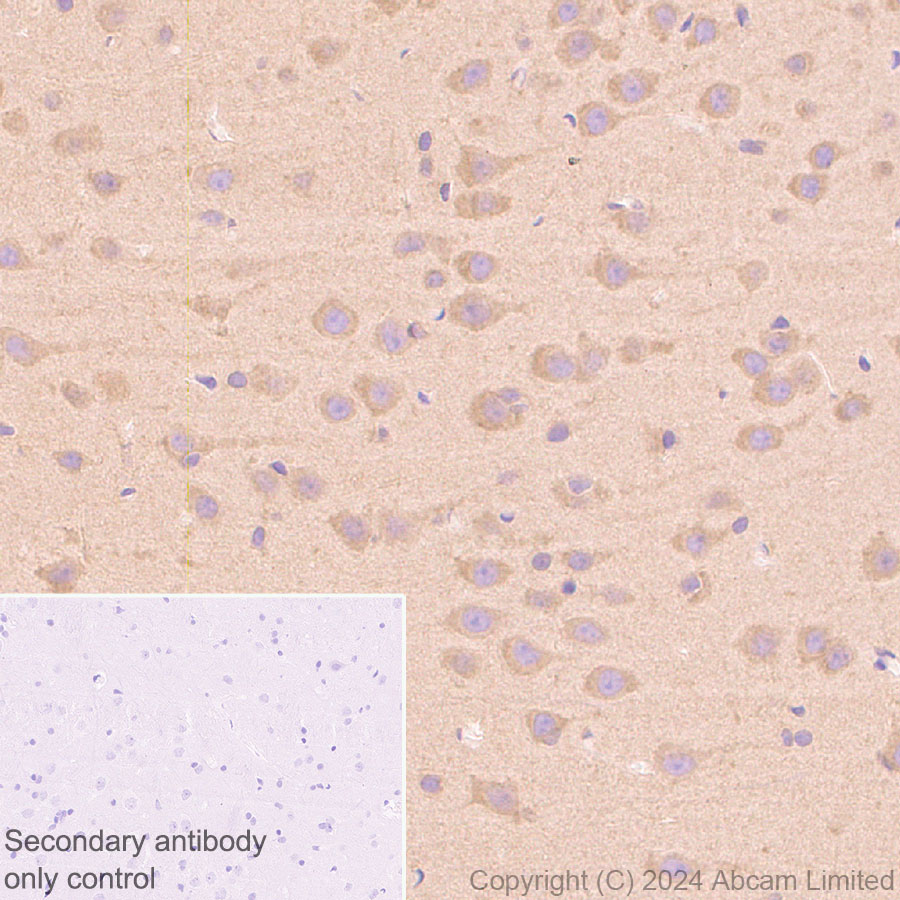 Rabbit specific IHC polymer detection kit HRP/DAB (ab209101) | Abcam