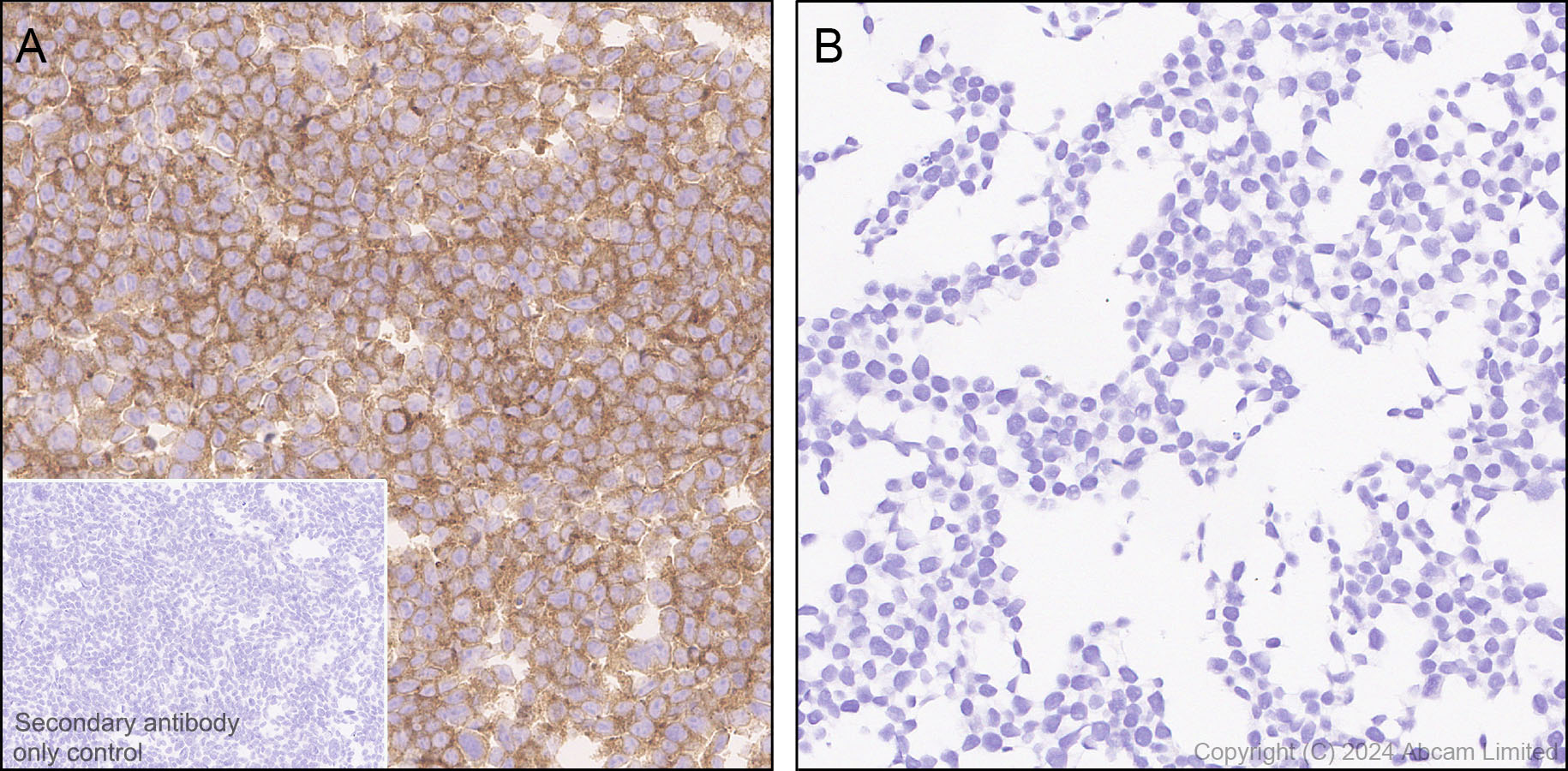Rabbit specific IHC polymer detection kit HRP/DAB (ab209101) | Abcam