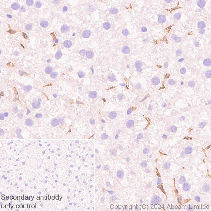 Rabbit specific IHC polymer detection kit HRP/DAB (ab209101) | Abcam