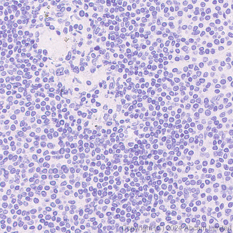 兔specific IHC polymer detection试剂盒HRP/DAB (ab209101)| Abcam中文官网