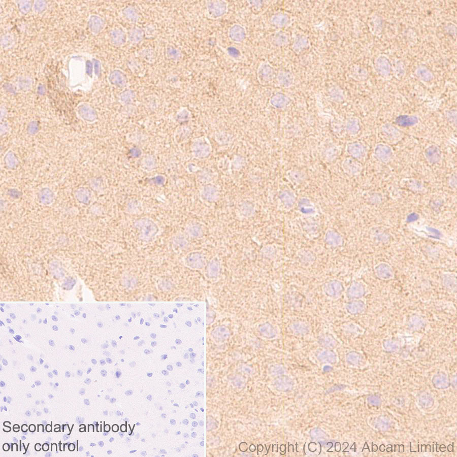 Rabbit specific IHC polymer detection kit HRP/DAB (ab209101) | Abcam
