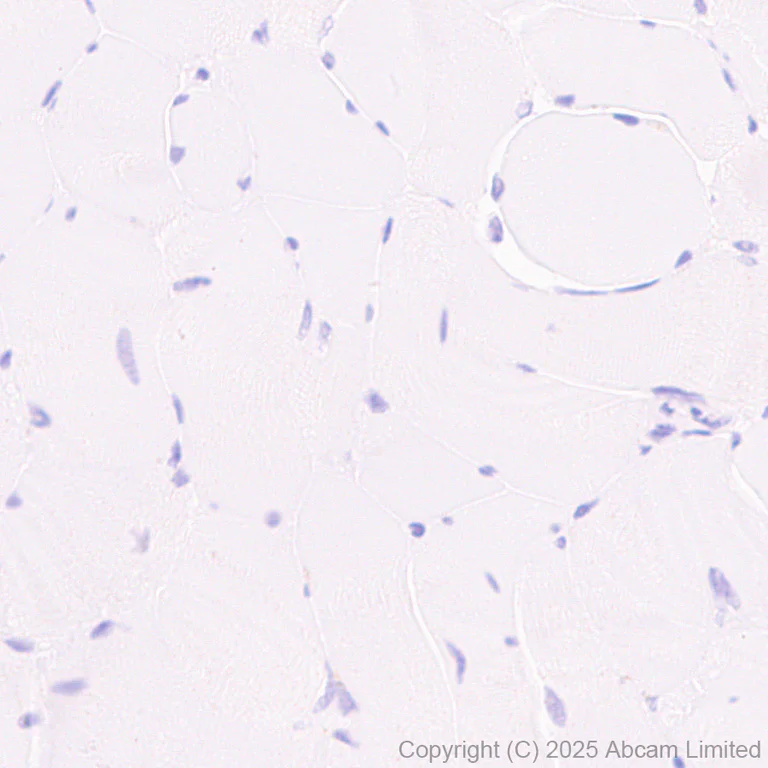 兔specific IHC polymer detection试剂盒HRP/DAB (ab209101)| Abcam中文官网