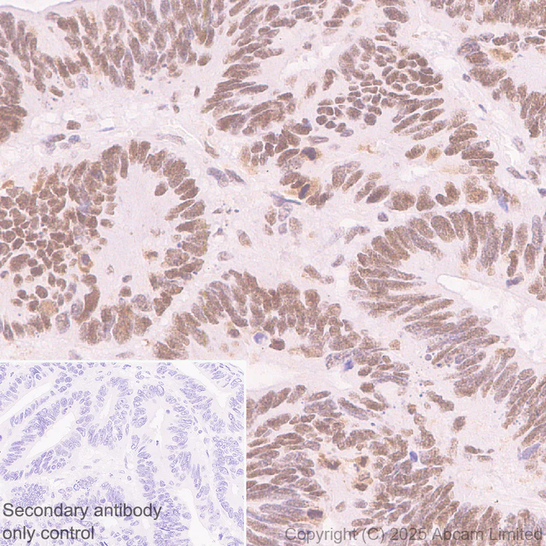 Rabbit specific IHC polymer detection kit HRP/DAB (ab209101) | Abcam
