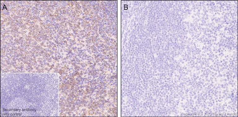 Rabbit specific IHC polymer detection kit HRP/DAB (ab209101) | Abcam