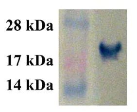 Rac2 Activation Assay Kit (ab211162) | Abcam