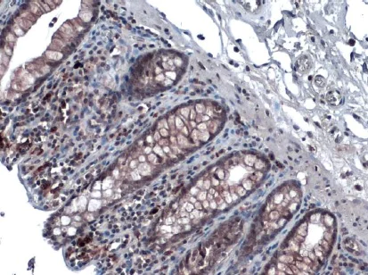 Anti-Rad51 antibody [14B4] (ab213) | Abcam
