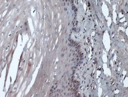 Anti-Rad51 antibody [14B4] (ab213) | Abcam