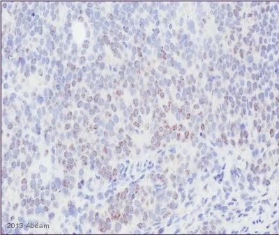 Anti-Rad51 antibody [14B4] (ab213) | Abcam