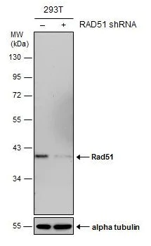 Anti-Rad51 antibody [14B4] (ab213) | Abcam