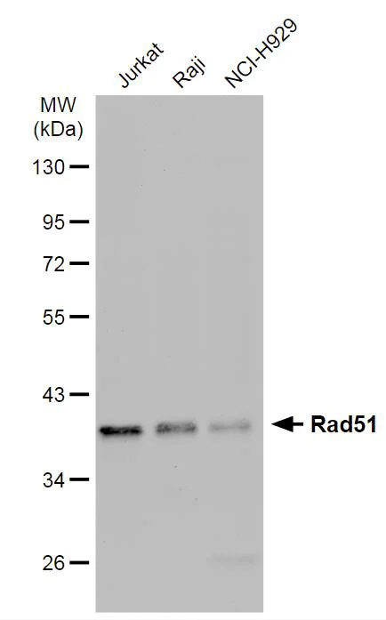 Anti-Rad51 antibody [14B4] (ab213) | Abcam