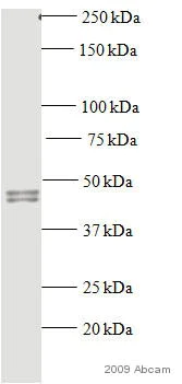 Anti-Rad51 antibody [14B4] (ab213) | Abcam