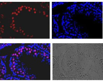 Anti-Rad51 antibody (ab176458) | Abcam