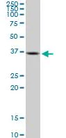 Anti-Rad51 antibody - BSA and Azide free (ab88572) | Abcam