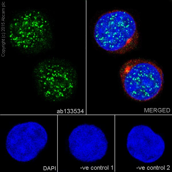 Anti-Rad51 antibody [EPR4030(3)] (ab133534) | Abcam