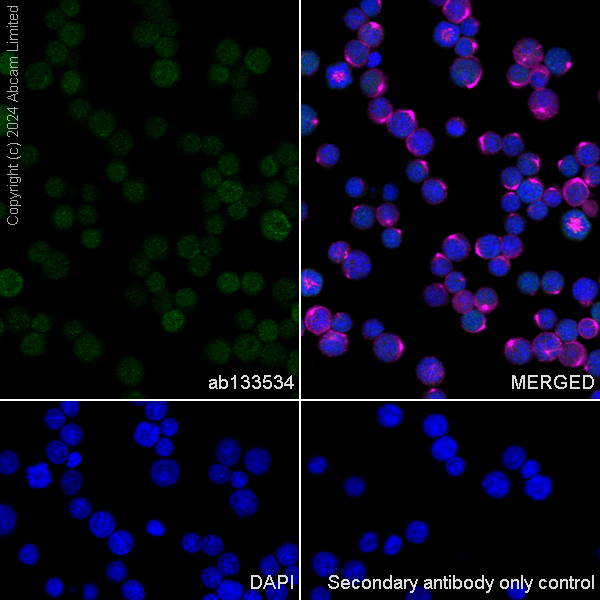 Anti-Rad51 antibody [EPR4030(3)] Rabbit monoclonal (ab133534) | Abcam