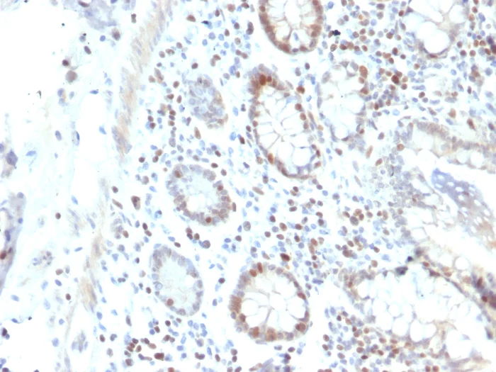 Anti-Rad51 antibody [RAD51/2702] (ab269677) | Abcam