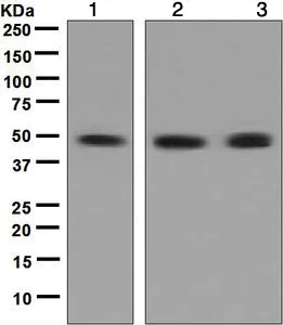 Anti-RAD52 antibody [EPR3464(2)] Rabbit monoclonal (ab124971) | Abcam