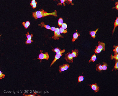 Anti-RAGE antibody (ab30381) | Abcam
