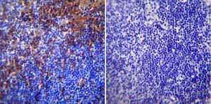 Anti-RAGE antibody (ab3611) | Abcam