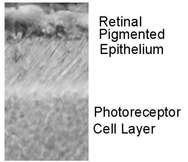Anti-RAGE 抗体 (ab3611) | Abcam