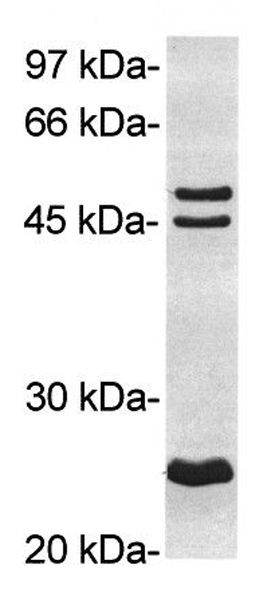 Anti-RAGE antibody (ab3611) | Abcam