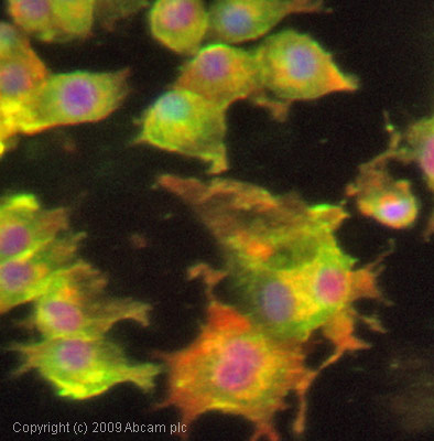 Anti-RAGE antibody (ab37647) | Abcam