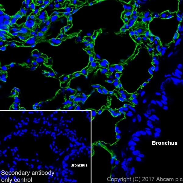 Anti-RAGE antibody [EPR21171] - BSA and Azide free (ab228861) | Abcam