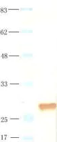 Anti-Rat immunoglobulin light chain-like 抗体 [KT100] (ab95376) | Abcam
