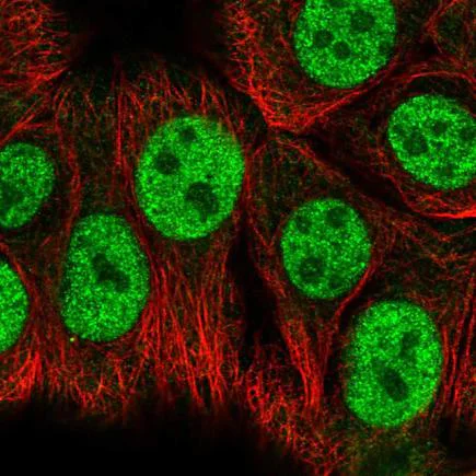 Anti-RB associated KRAB repressor antibody (ab222219) | Abcam