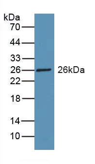 Anti-RBP3/IRBP antibody (ab233190) | Abcam