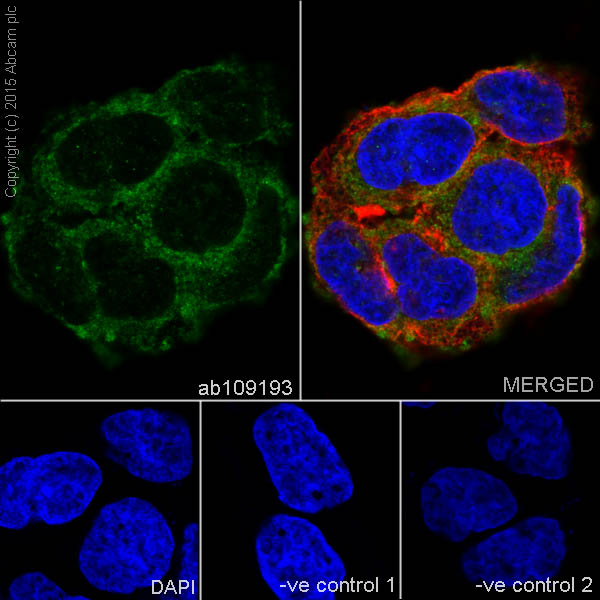 Anti-RBP4 antibody [EP3657] (ab109193) | Abcam