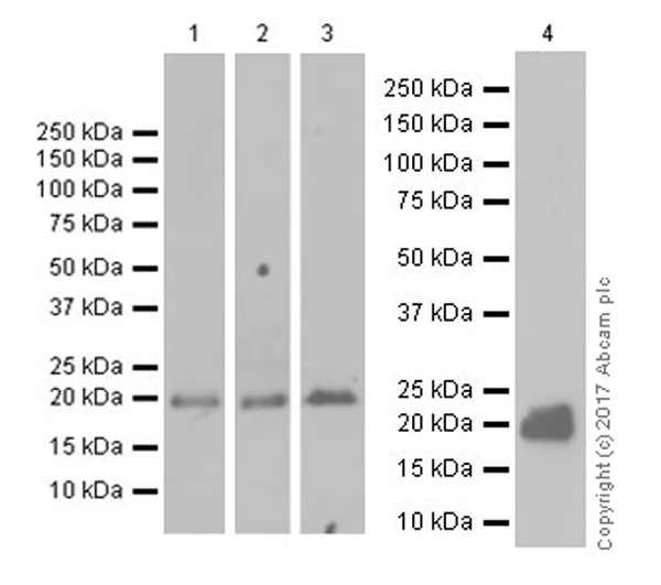 Anti-RBP4 antibody [EPR18020-115] (ab188230) | Abcam