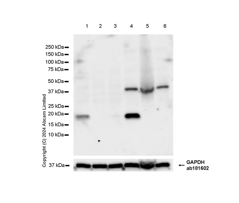 Anti-RBP4 antibody [EPR18020-115] (ab188230) | Abcam