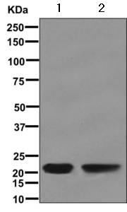 Anti-RD3 antibody [EPR12169(B)] (ab171946) | Abcam